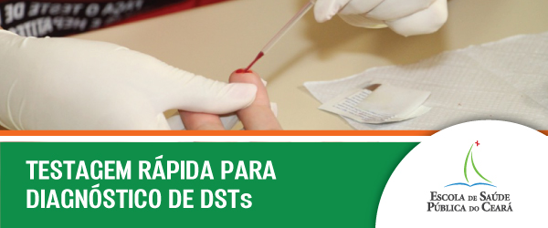 Centro de Saúde Meireles faz testes de DSTs - Escola de Saúde Pública ...